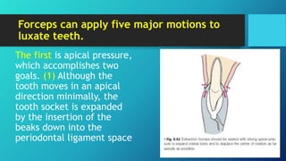 Mechanical Principles Involved in Tooth Extraction 1 | PPTX