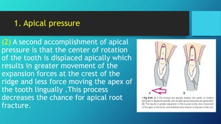 Mechanical Principles Involved in Tooth Extraction 1 | PPTX
