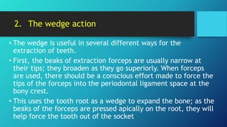 Mechanical Principles Involved in Tooth Extraction 1 | PPTX