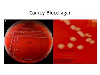 lec8& 9-campylobacter and h. pylori bacteriology.pptx