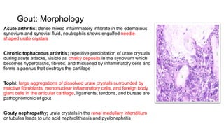Lec arthritis | PPT