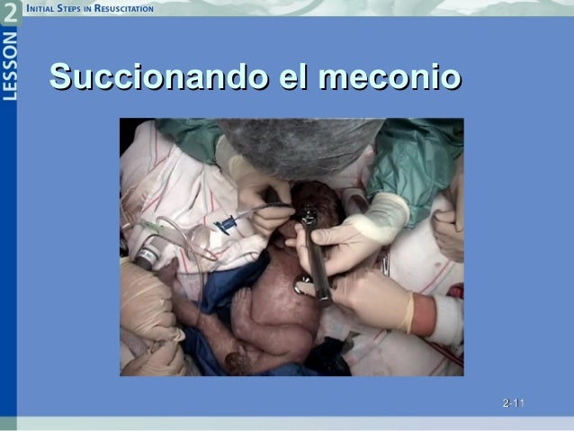 Lección 2 Reanimación Neonatal 6ta edición