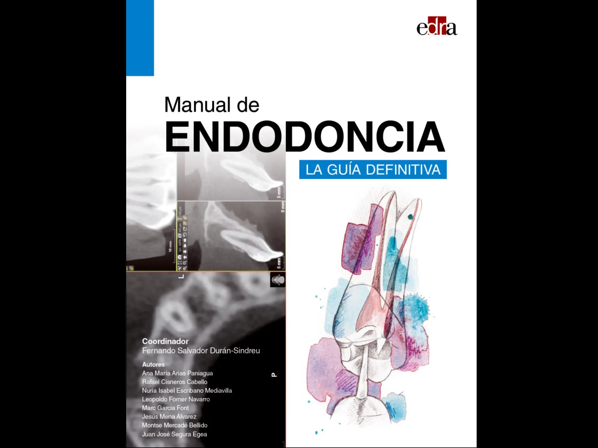 Etiopatogenia del complejo pulpo-periapical.pdf