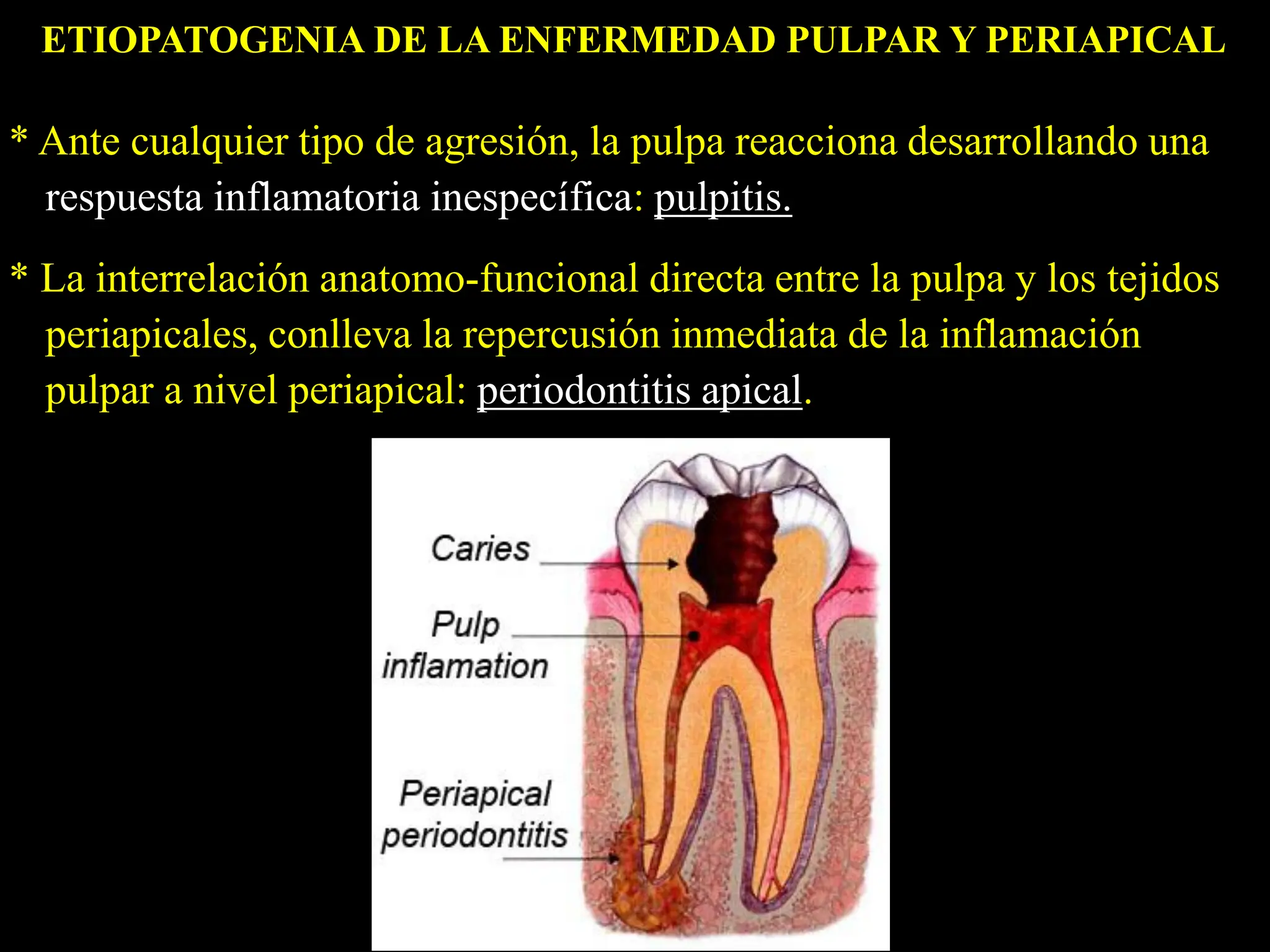 Etiopatogenia del complejo pulpo-periapical.pdf