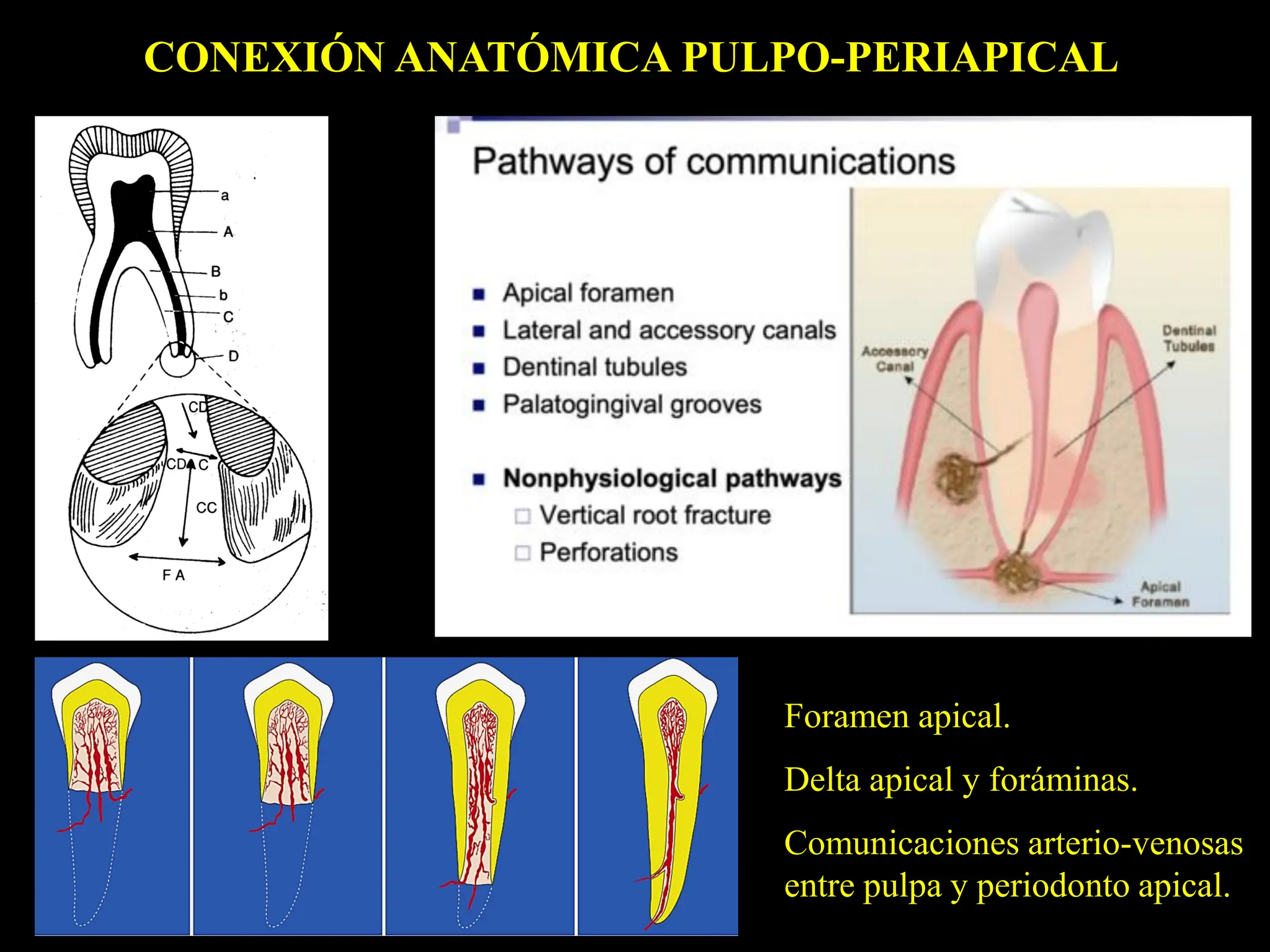 Etiopatogenia del complejo pulpo-periapical.pdf
