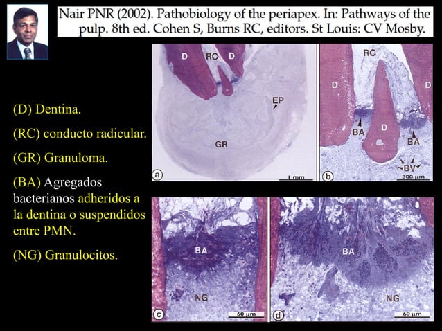 Etiopatogenia del complejo pulpo-periapical.pdf