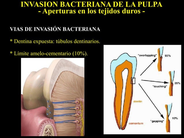 Etiopatogenia del complejo pulpo-periapical.pdf