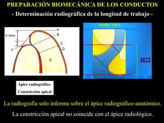 Anatomia apical. Longitud de trabajo endodoncia | PDF