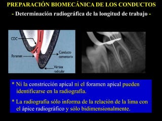 Anatomia apical. Longitud de trabajo endodoncia | PDF
