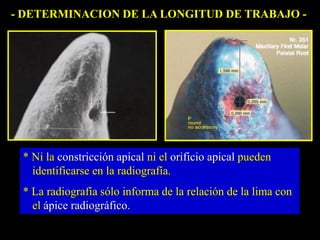 Anatomia apical. Longitud de trabajo endodoncia | PDF