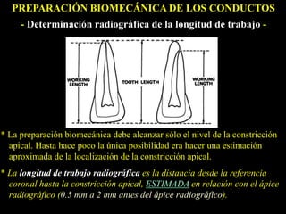Anatomia apical. Longitud de trabajo endodoncia | PDF