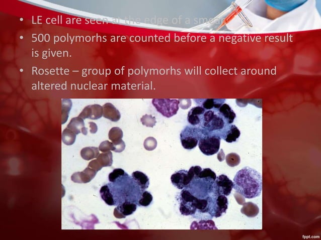 Le cell | PPTX | Blood Disorders | Diseases and Conditions