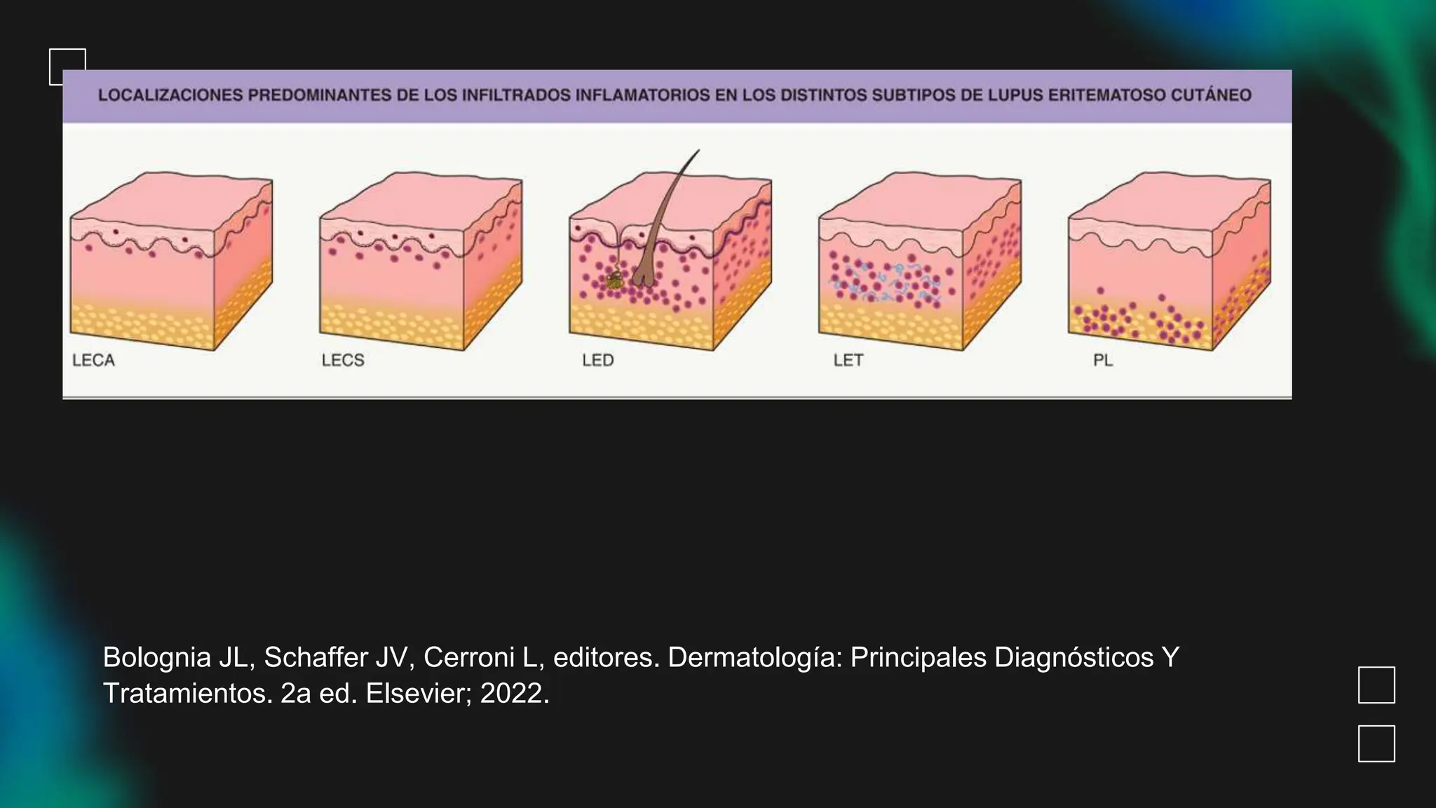 lupus eritematoso cutaneo y sus variantes | PPT
