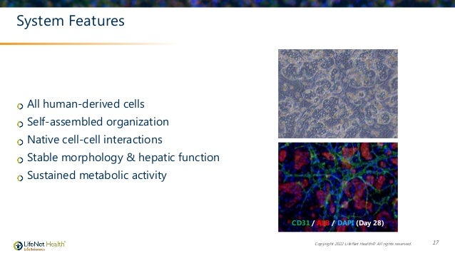 A Novel, All-Human Hepatic Triculture System | PPTX