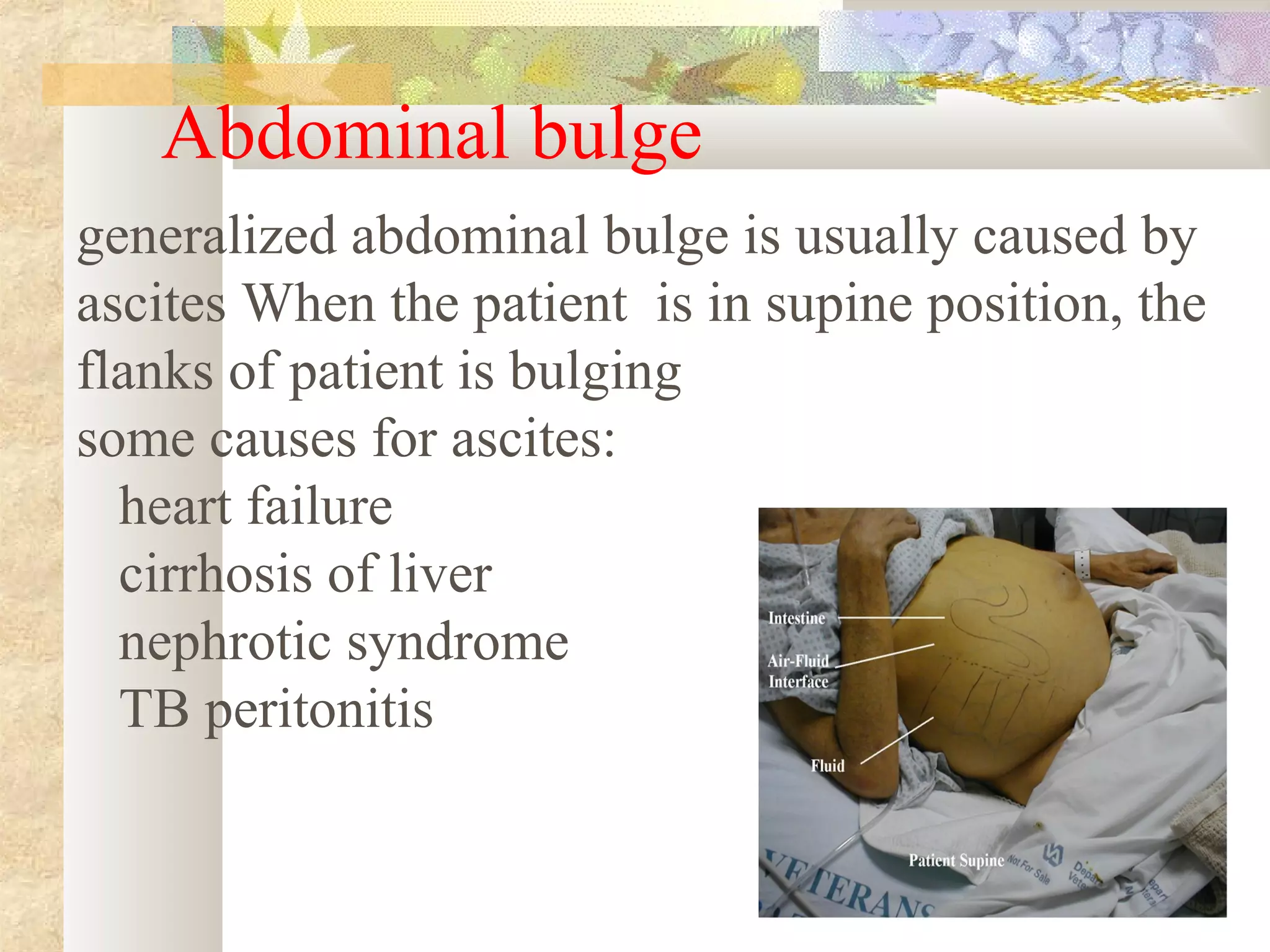 abdominal assessment | PPT