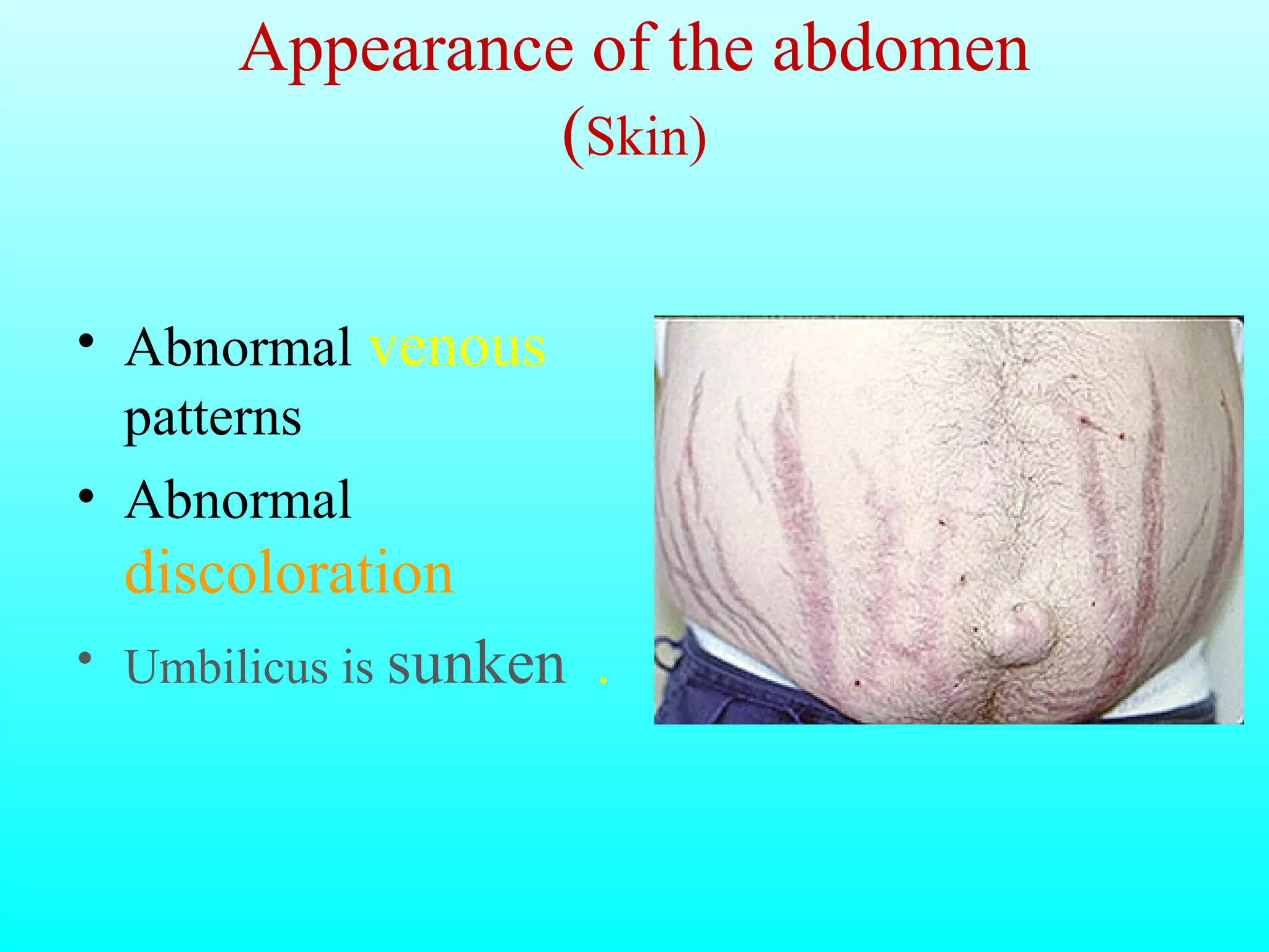 abdominal assessment | PPT