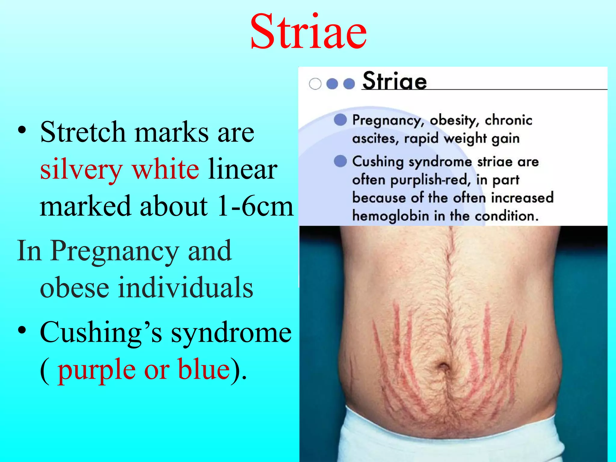 abdominal assessment | PPT