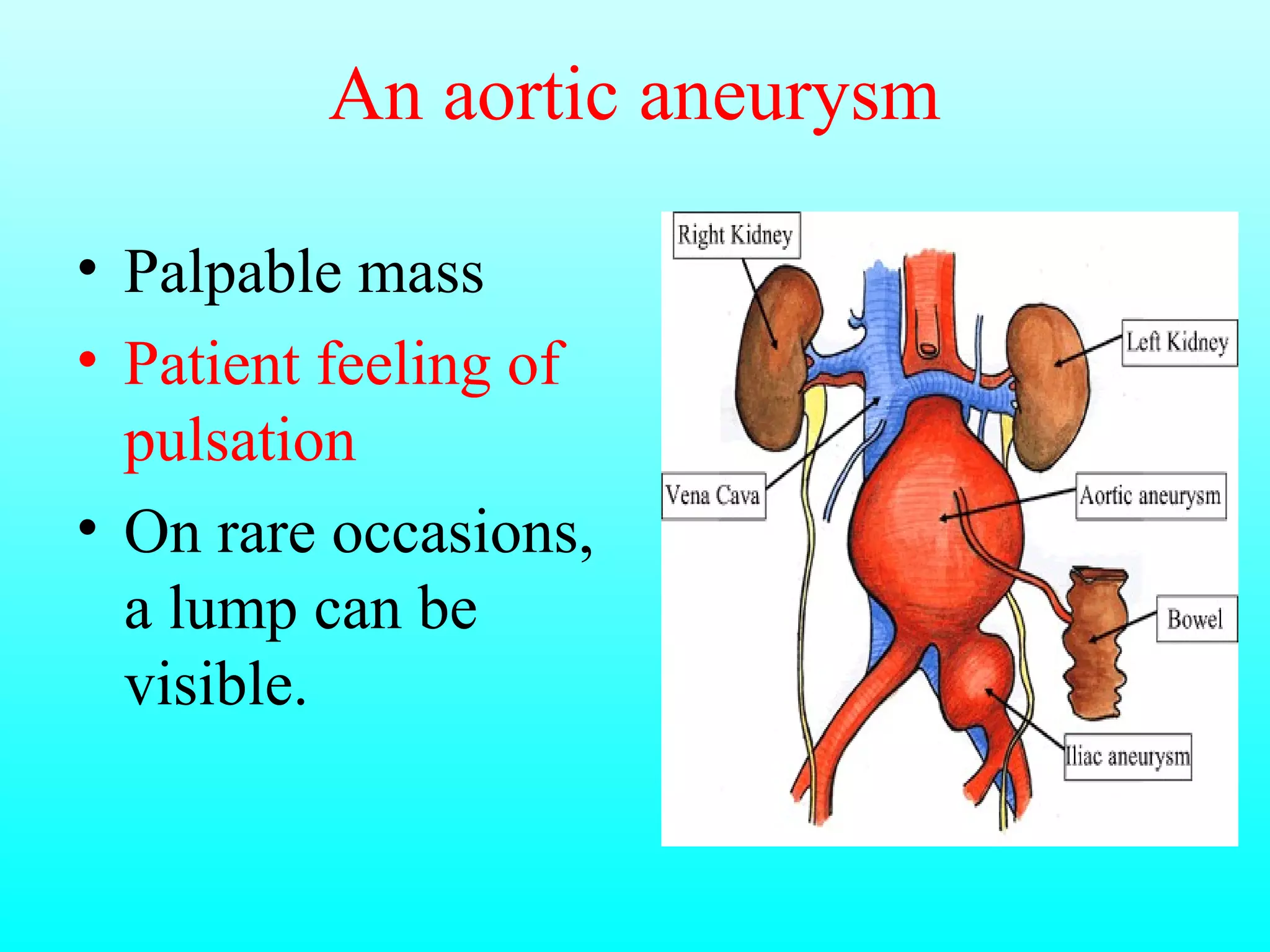 abdominal assessment | PPT