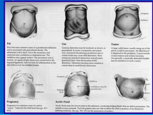 abdominal assessment
