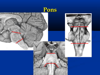 Lect -brainstem | PPT