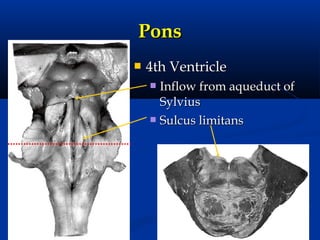 Lect -brainstem | PPT