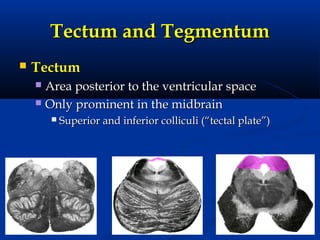 Lect -brainstem | PPT