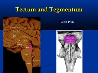 Lect -brainstem | PPT