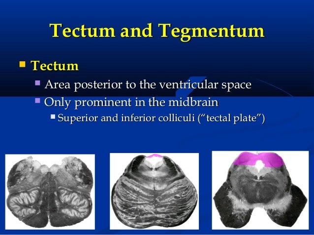 Tectal Plate Anatomy