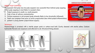 Lect.5 pulp treatment final | PPT