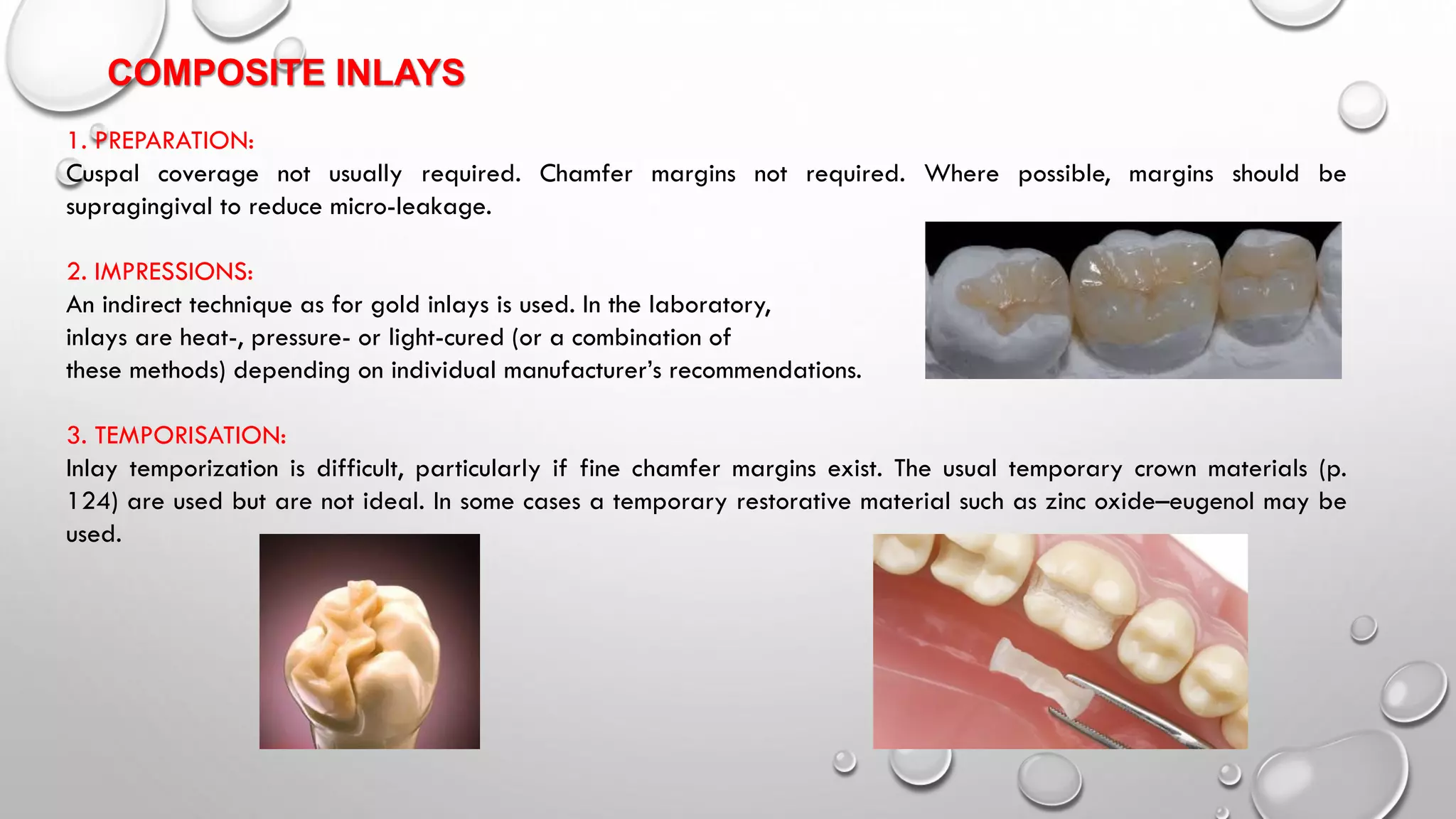 Lect.6 indirect esthetic adhesive restorations | PDF