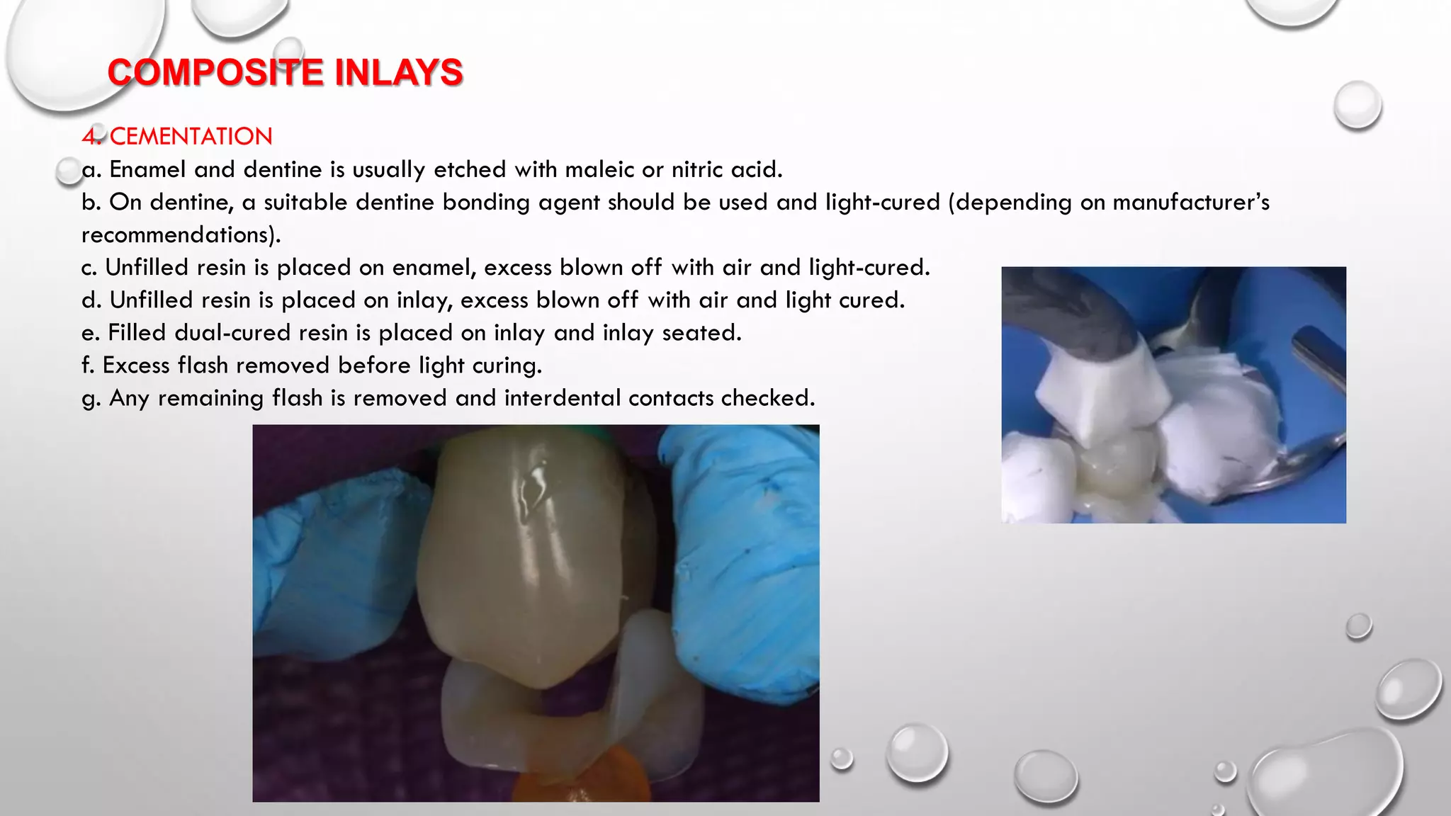 Lect.6 indirect esthetic adhesive restorations | PDF
