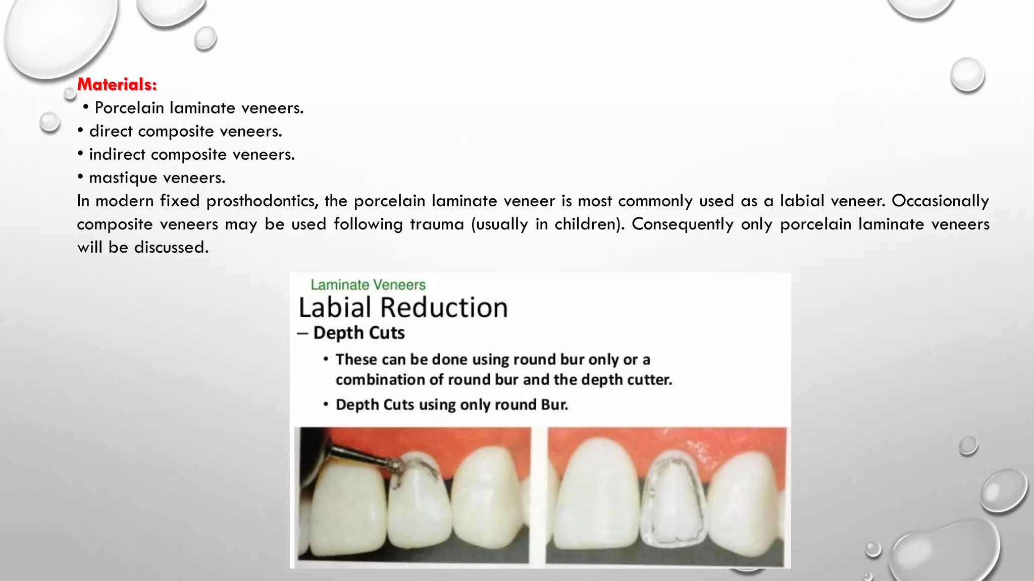 Lect.6 indirect esthetic adhesive restorations | PDF