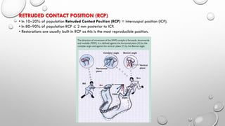 Lect.7. Tooth bleaching and occlusion | PPT
