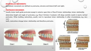 Lect.7. Tooth bleaching and occlusion | PPT