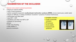 Lect.7. Tooth bleaching and occlusion | PPT