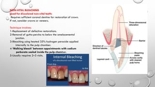 Lect.7. Tooth bleaching and occlusion | PDF