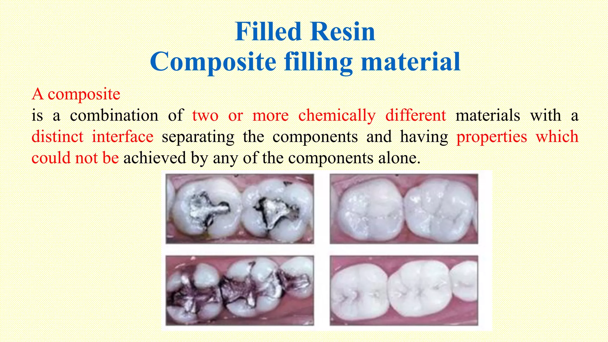 Tooth Color Restorations (Composite) 2018-2019 | PDF