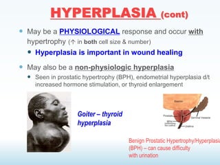 Lect 2- cellular adaptation | PPT