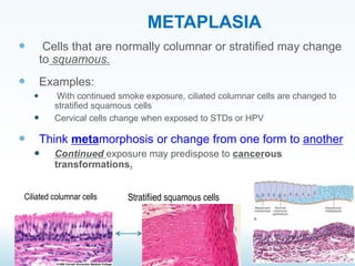 Lect 2- cellular adaptation | PPT
