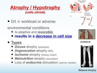 Lect 2- cellular adaptation | PPT