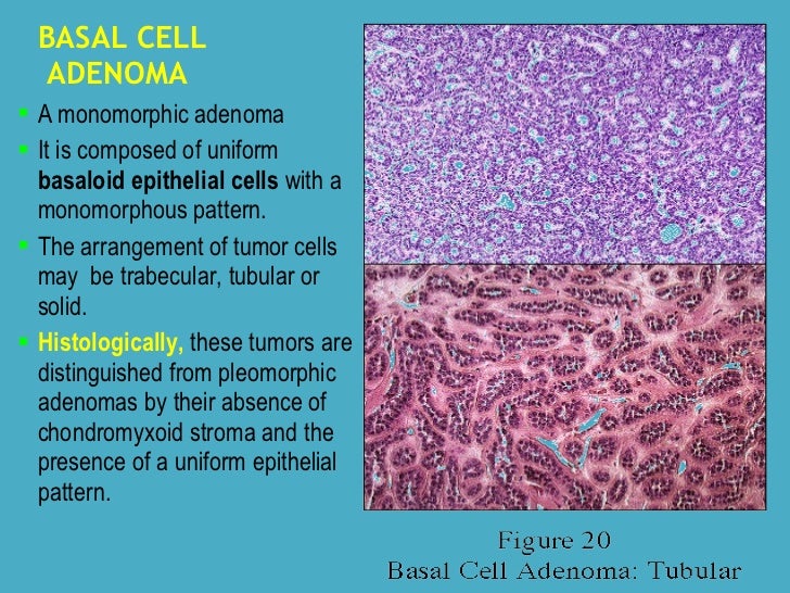 Lect.2. salivary gland pathology