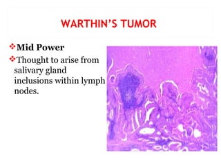 Lect.2. salivary gland pathology | PPT