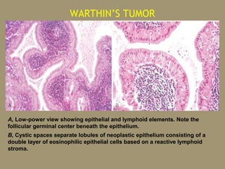 Lect.2. salivary gland pathology | PPT
