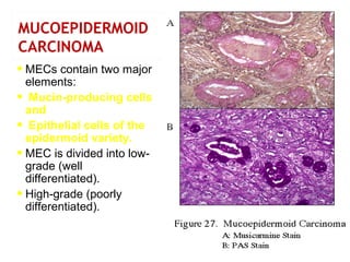 Lect.2. salivary gland pathology | PPT