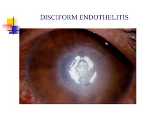 Lect._II_Cornea copy.pptx