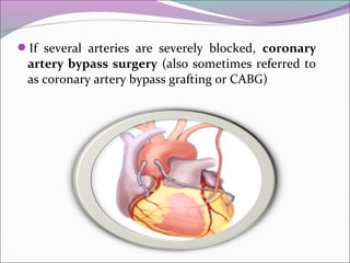 Lect 2 angina | PPT