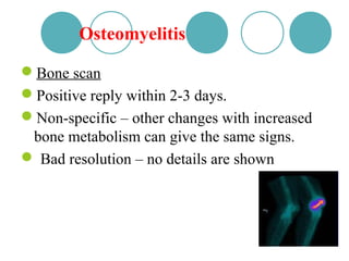 Osteomyelitis | PPT