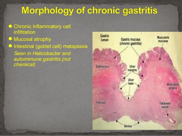 Lect 4- gastric disorder