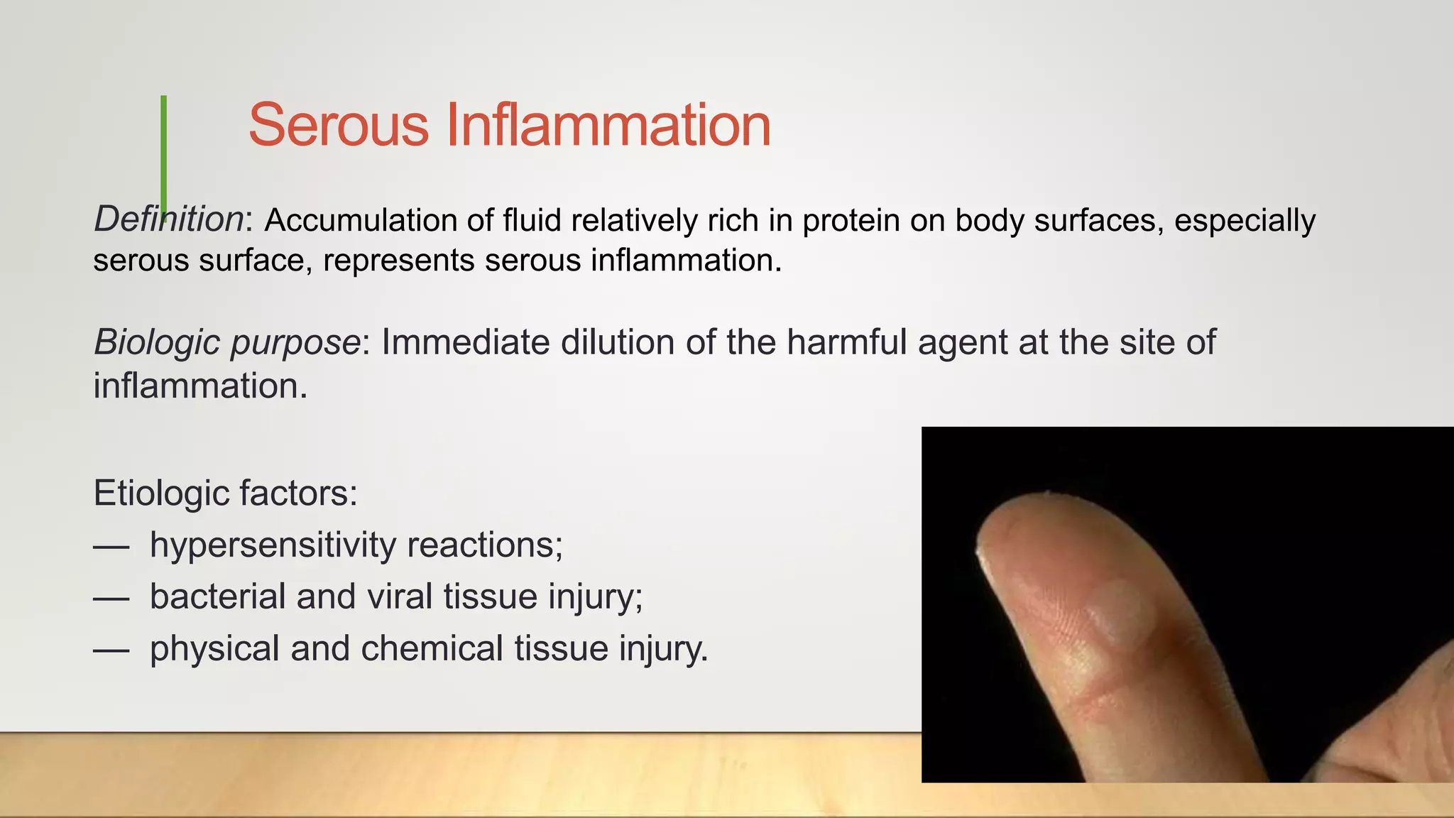 Lect 4-inflammation-2- | PPTX
