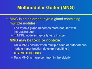 Goiter | PPT